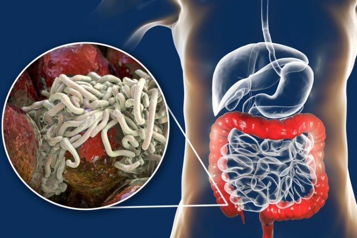 Cegah Penyakit Cacingan, Ketahui Tiga Jenis Obat dan Cara Penggunaannya
