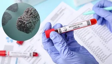 Bandara Bali Pasang 3 Thermal Scanner untuk Deteksi Awal Virus Mpox