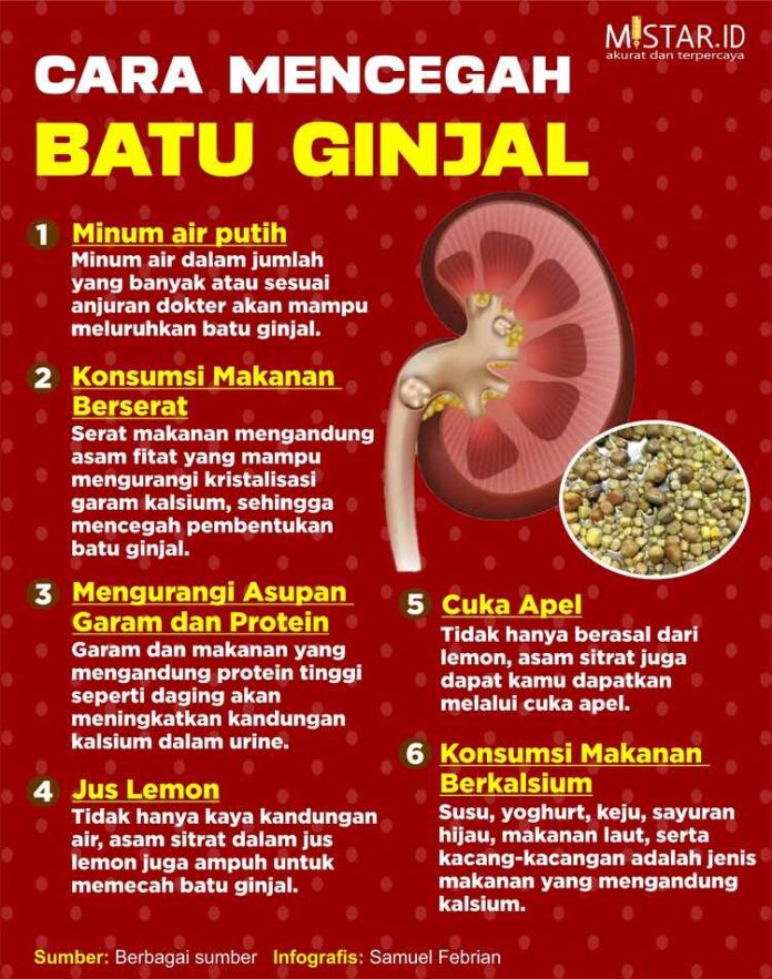 Cara Mencegah Batu Ginjal